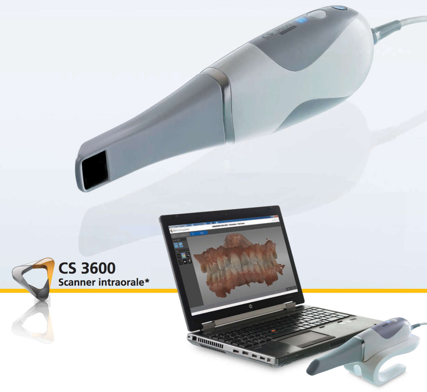 Impronta dentale a tecnologia digitale - Dental Smile Clinic